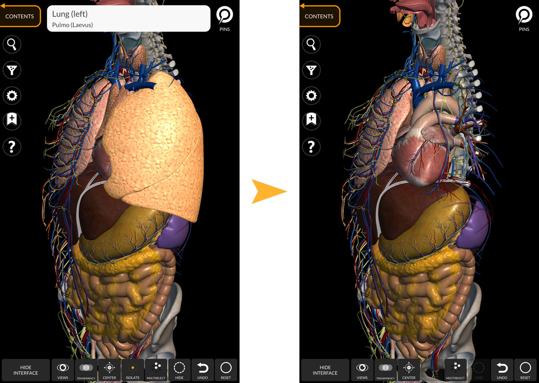 Human Anatomy Atlas App Free For Iphone Stashokkorean